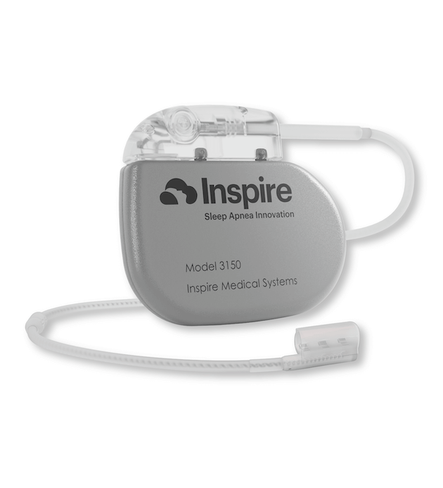 Inspire Sleep Surgery